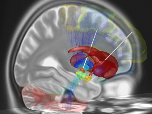 Stimulating the Connectome | The Neuro Bureau