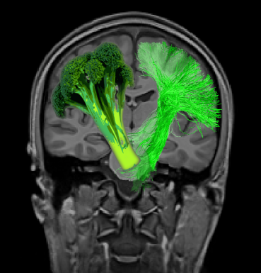 Brain Broccoli | The Neuro Bureau