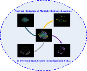 Abstract Illustration of Multiple Electrodes Locations in Detecting ...