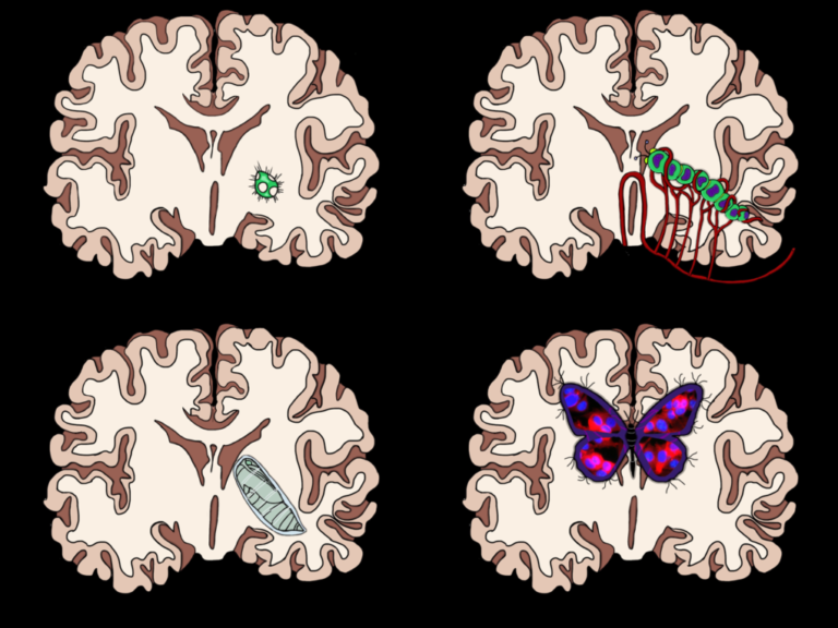 Metamorphosis | The Neuro Bureau